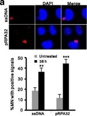 RPA2 [p Ser33] Antibody (NB100-544): Novus Biologicals